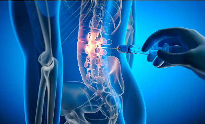 Could a Simple Injection Therapy End Your Chronic Back Pain? - Articlesify
